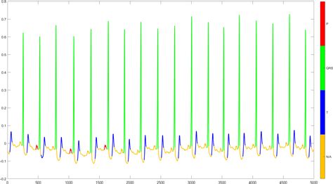 Github Hassan1503matlab Udf Personal Define Function