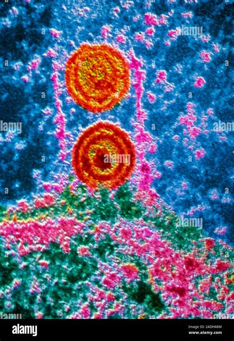 False Colour Transmission Electron Micrograph Tem Of Virions Virus Particles Orange Of The