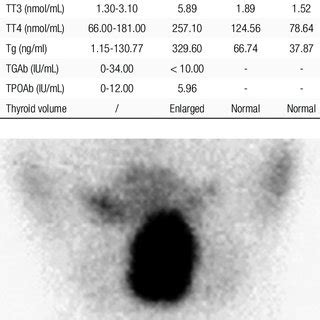 Detection Of Thyroid Function Of Family Members Download Table