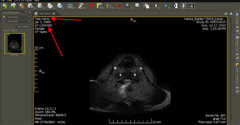 Modify Dicom File Metadata Using Dcm4che In Java ~ 360learntocode