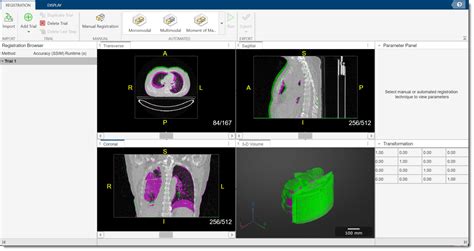 Deformable Registration Using Medical Registration Estimator App Matlab And Simulink