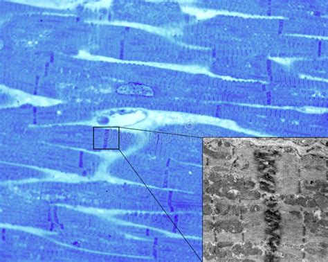 Heart Myocardium Intercalated Discs Stock Image Image Of Inset Discs 230453281