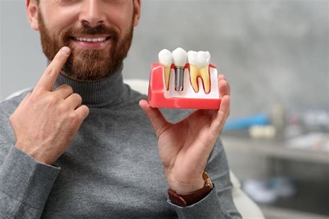 Dental Implants And Bridges To Replace Multiple Missing Teeth White