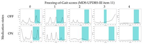 An Explainable Spatial Temporal Graphical Convolutional Network To