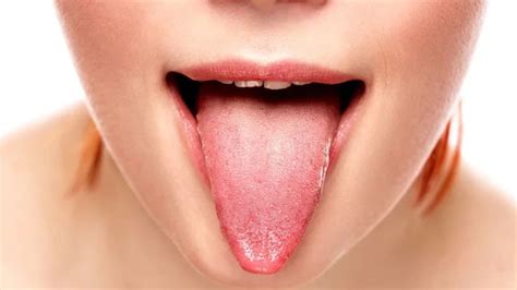 Glossitis Disease গরম নোনতা ঝাল খেলেই জিভে জ্বালা Bengali News