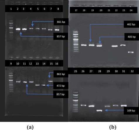 What Is The Difference Between Esbl And Ampc At Wade Arnold Blog