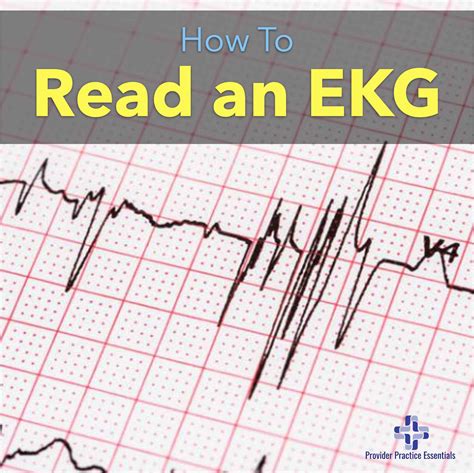 How To Read An EKG