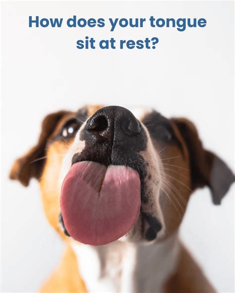 🦷 Tongue Position Key To Tmj Health 🦷 The Position Of Your Tongue At