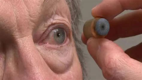 Is A Scleral Shell Right For Me All About Our Handcrafted Scleral Shells