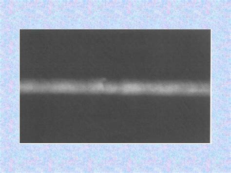 Types Of Radio Graphic Rt Weld Examination Defects Ppt Medical Tests Medical Health