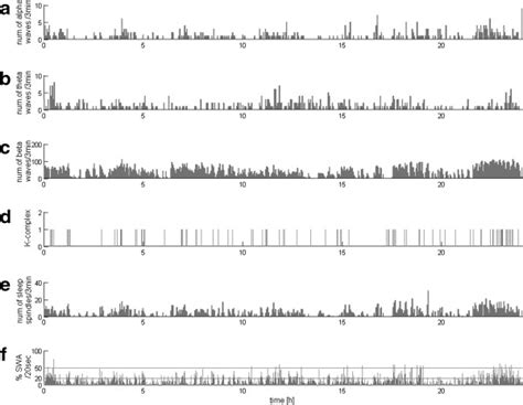 Eeg Profile Of 24 Hours Recording An Example Of Continuous Monitoring Download Scientific