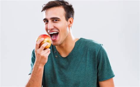 Braces Archives Orthodontics Limited