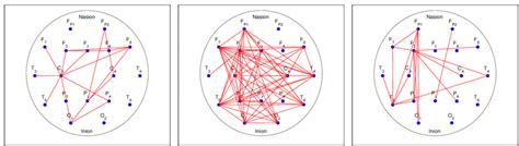 Sample Eeg Synchronization Graphs For Pre Ictal Ictal And Post Ictal Download Scientific