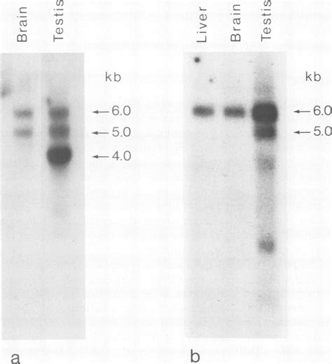 Expression Of The C Abl Gene In Different Tissues Equal Amounts Of Download Scientific Diagram