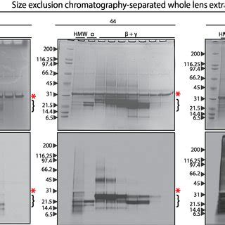 Analysis Of L IsoAsp Damage In The Native Size Exclusion Fractions Of Download Scientific