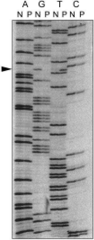 Manual Dna Sequencing Of Exon 17 In Control N And Md 138 P The