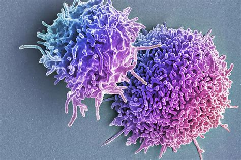 Multi Virus Specific T Cells To Treat Post Transplant Viral Infections