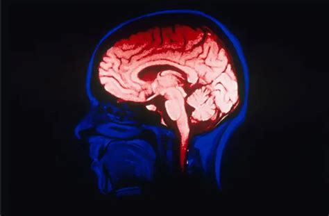 a machine learning engineer s tutorial to transfer learning for multi class image segmentation