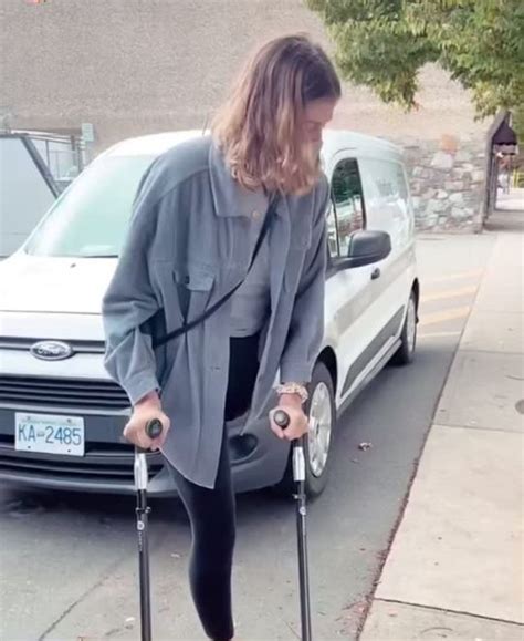 Post Amputeeloverx Tumblr Com Tumbex