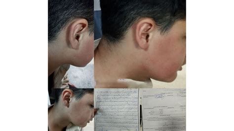 جزئیات تنبیه بدنی دانش آموز لاهیجانی توسط معلم لغو ابلاغ معلم خاطی