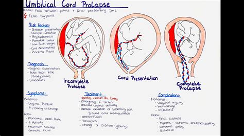 Brittle Umbilical Cord At Arlene Perkins Blog