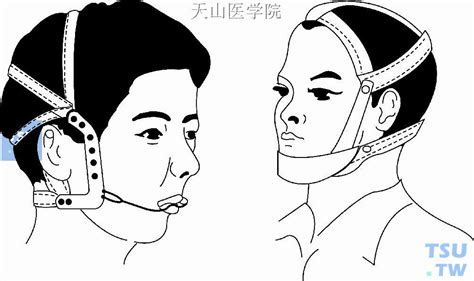 附图 正畸矫治器的概念 口腔医学 天山医学院