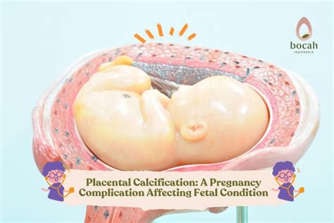 Placental Calcification A Pregnancy Complication