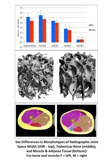 Image Analysis Group On Linkedin Imagingtrial Osteoarthritis