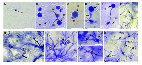 Microscopic Analysis Of The Progression Of Phytophthora Capsici Download Scientific Diagram
