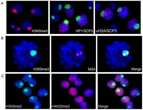 A Co Immunostaining Of H3k9me3 Red Hp1 Green Uh2a Green With