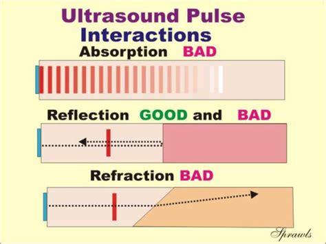 My Life Ultrasound Production And Interactions