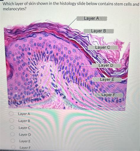 [solved] Which Layer Of Skin Shown In The Histology Slide Below