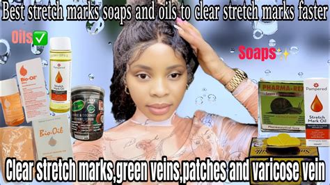 Super Effective Bar Soaps And Oils To Help Clear Stretch Marks Faster Clear Green Veins White