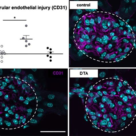 Histological Evaluation Of Cd31 Positive Area In Glomeruli Of Control