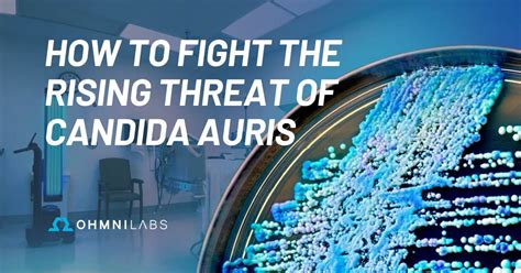 How To Fight The Rising Threat Of Candida Auris OhmniLabs