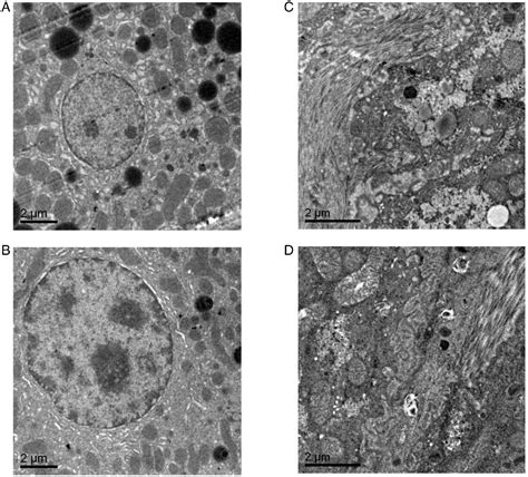 Figure 6 From Sex Differences In Diabetes‑induced Hepatic And Renal