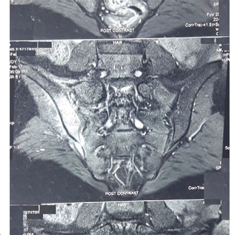 Basic Hematological And Biochemical Investigations Download Table