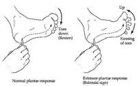 Plantar Reflex Edumedweb