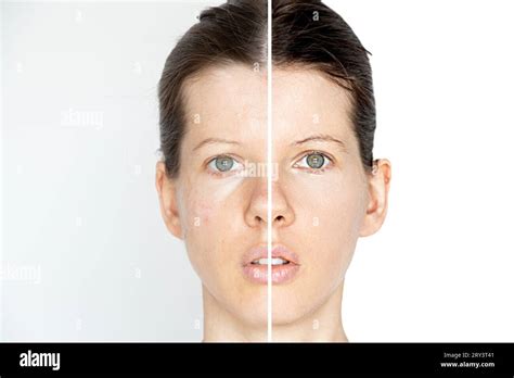 The Face Of A Young Girl With Frequency Processing Of One Half Of The