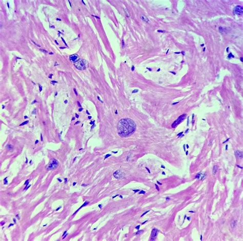 Hypertrophy Muscle Microscope