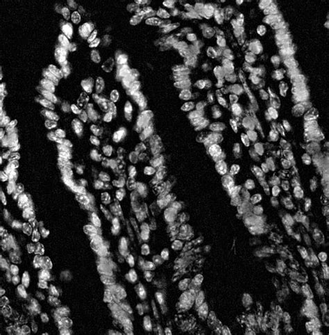 Dapi Channel Image Adjustment Cell Segmentation Image Analysis Image Sc Forum