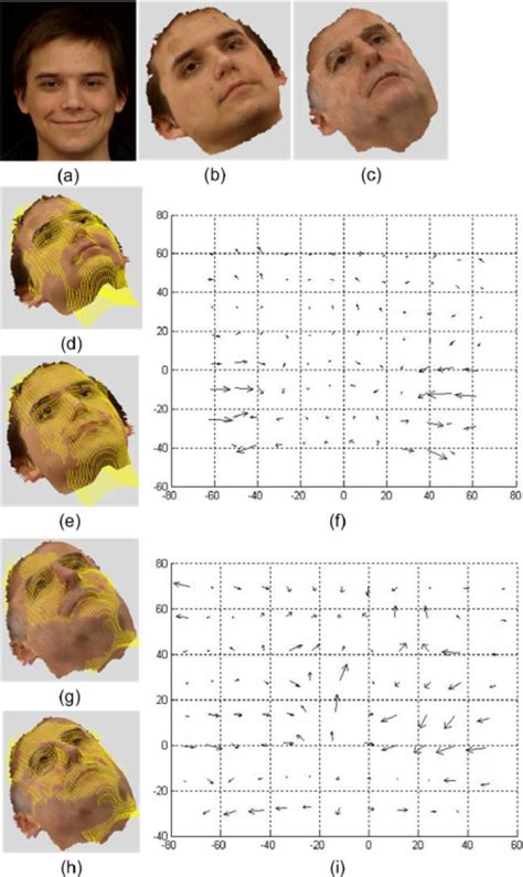 An Example Of Registration And Displacement Vector Field Generation Download Scientific