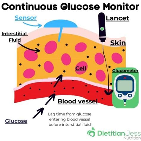 Dexcom G7 Review Dietitian Jess Nutrition