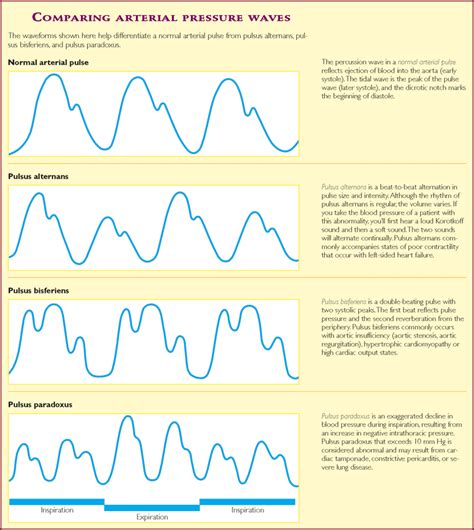 Doctors Gates Shapes Of Arterial Pressure Waves