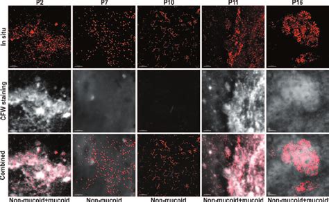 Distribution Of P Aeruginosa Populations In Cf Sputum Sputum Samples Download Scientific