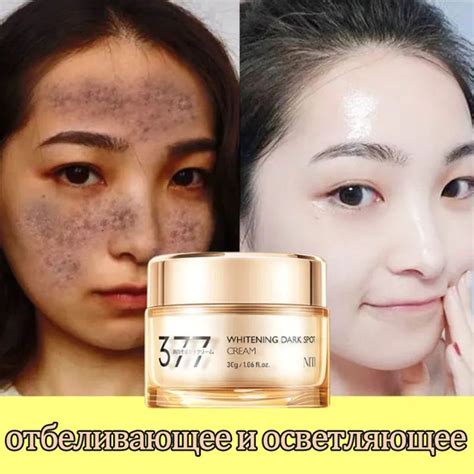 Натуральный отбеливающий крем для лица Средство против пигментации отбеливающий и осветляющий