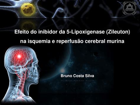 Efeito Do Inibidor Da 5 Lipoxigenase Zileuton Na Isquemia E