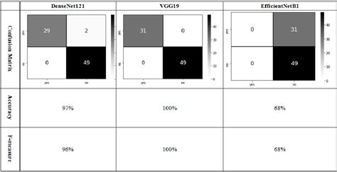 Figure 1 From Fine Tuning Cnn For Covid 19 Patterns Detection From Figure 1 From Fine Tuning Cnn For Covid 19 Patterns Detection From