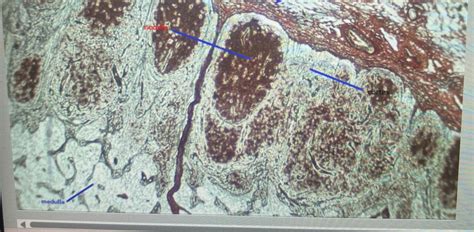 Solved Please Labelbthe Capsule Medulla Cortex And Nodule
