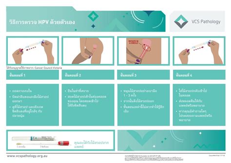 How To Take Your Own Hpv Test Thai By Victorian Cytology Service Issuu